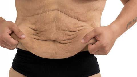 Skin in the Game: Strategies for Dealing with Loose Skin After Weight